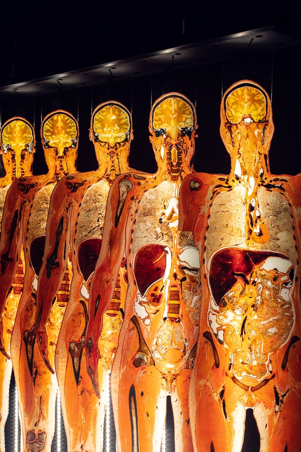 The ‘Anatomy of Happiness’ laid bare in BODY WORLDS exhibition – X ...